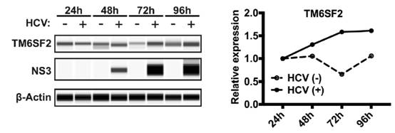 Wes/Jess Simple 全自动定量Western Blot病原微生物感染研究案例 - 生物通