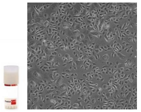 新品推介 | 气-液界面培养：深入了解我们的气道 - 生物通